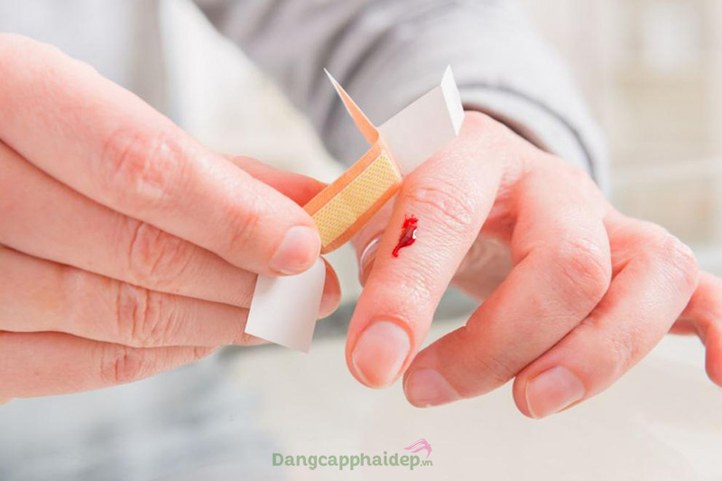 Bị trầy xước nên ăn gì để vết thương nhanh lành?